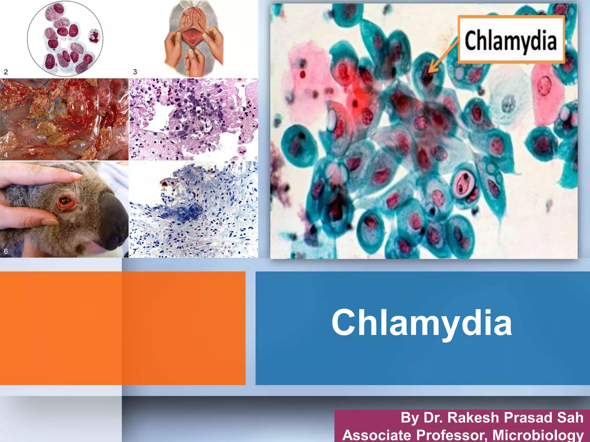 Chlamydia | PPT