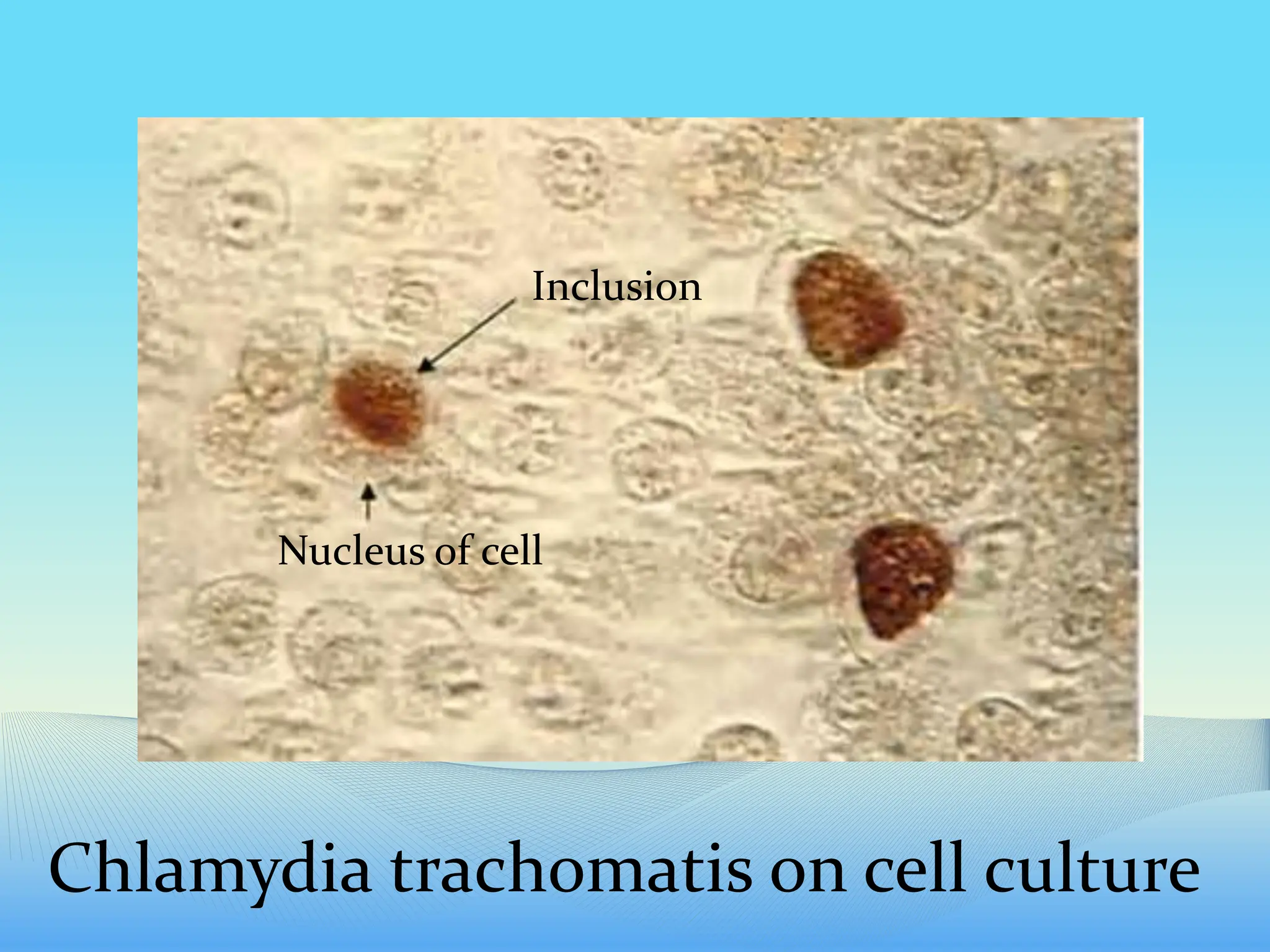 CHLAMYDIA by Dr munir HMC PICO.slideshare | PPTX
