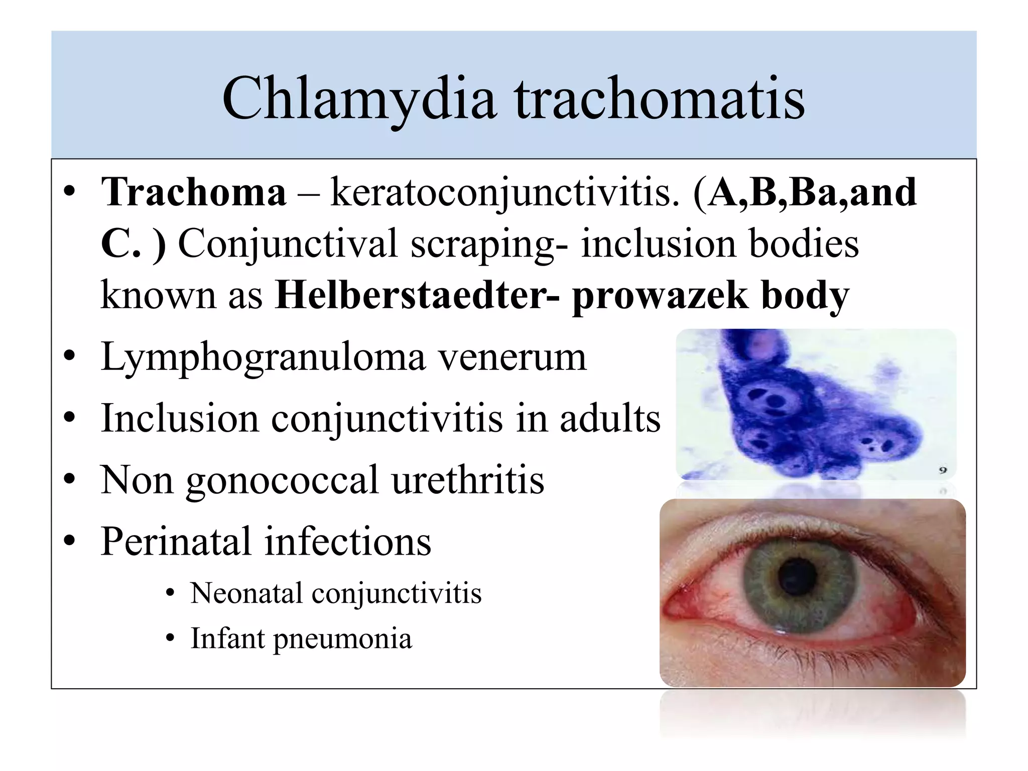 Chlamydia and mycoplasma | PPTX