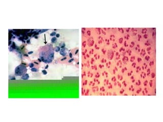 Chlamydia and mycoplasma | PPT