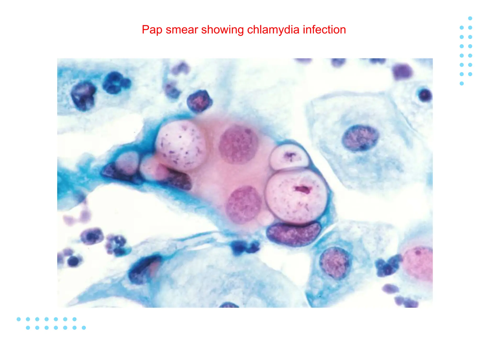 Chlamydia Edited.pptx , Chlamydia trachomatis | PPTX