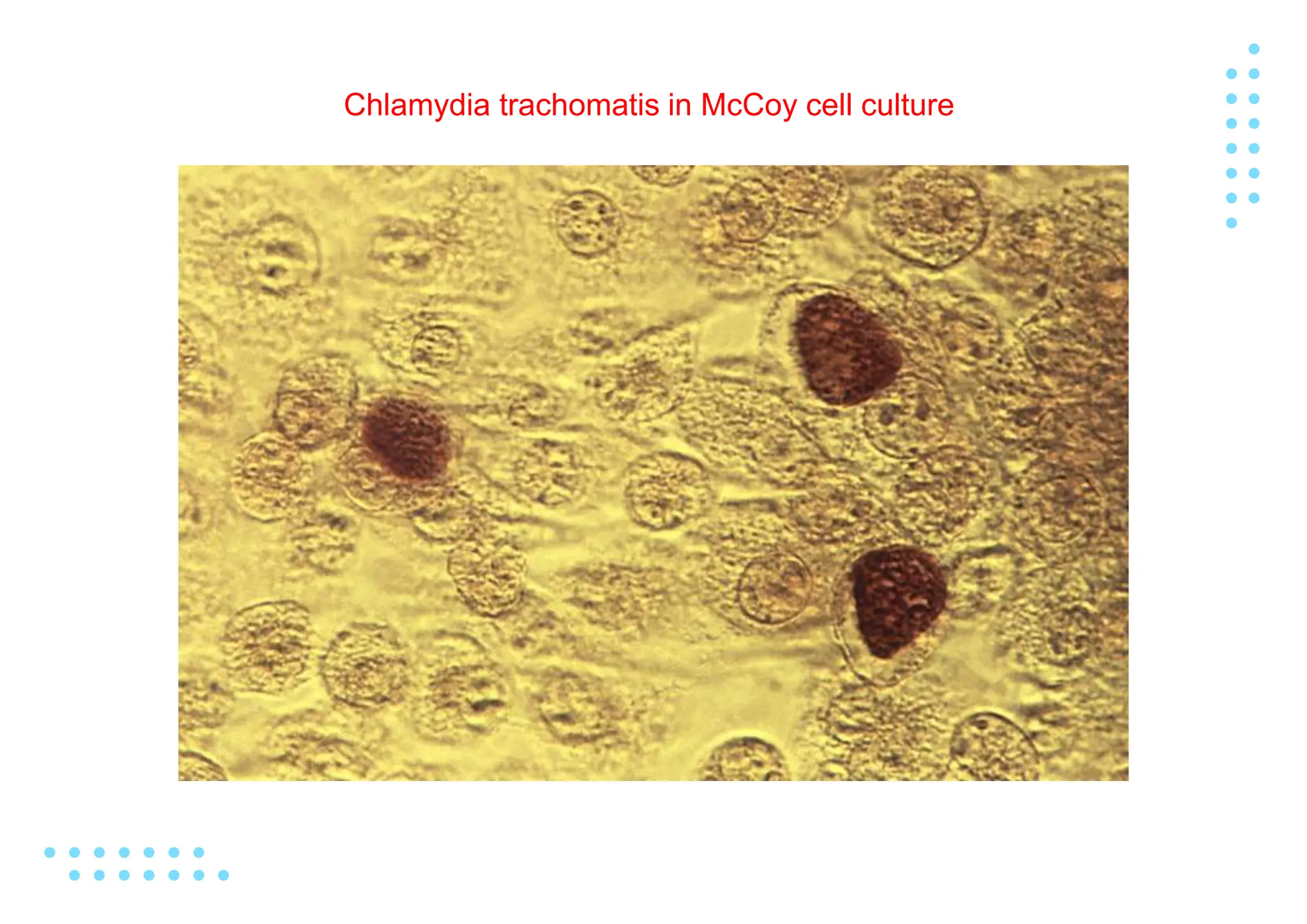 Chlamydia Edited.pptx , Chlamydia trachomatis | PPTX