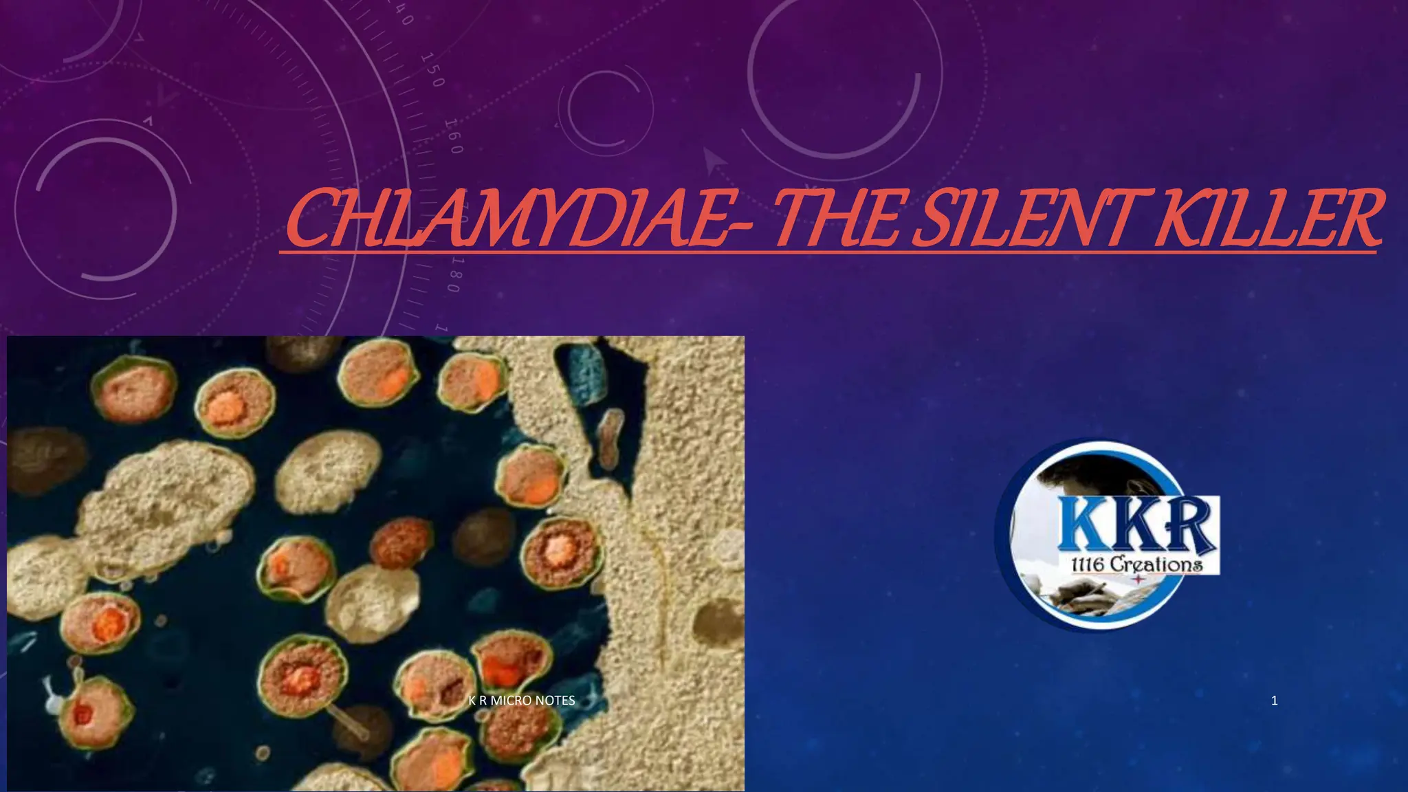 Chlamydiae The silent killer K R.pptx