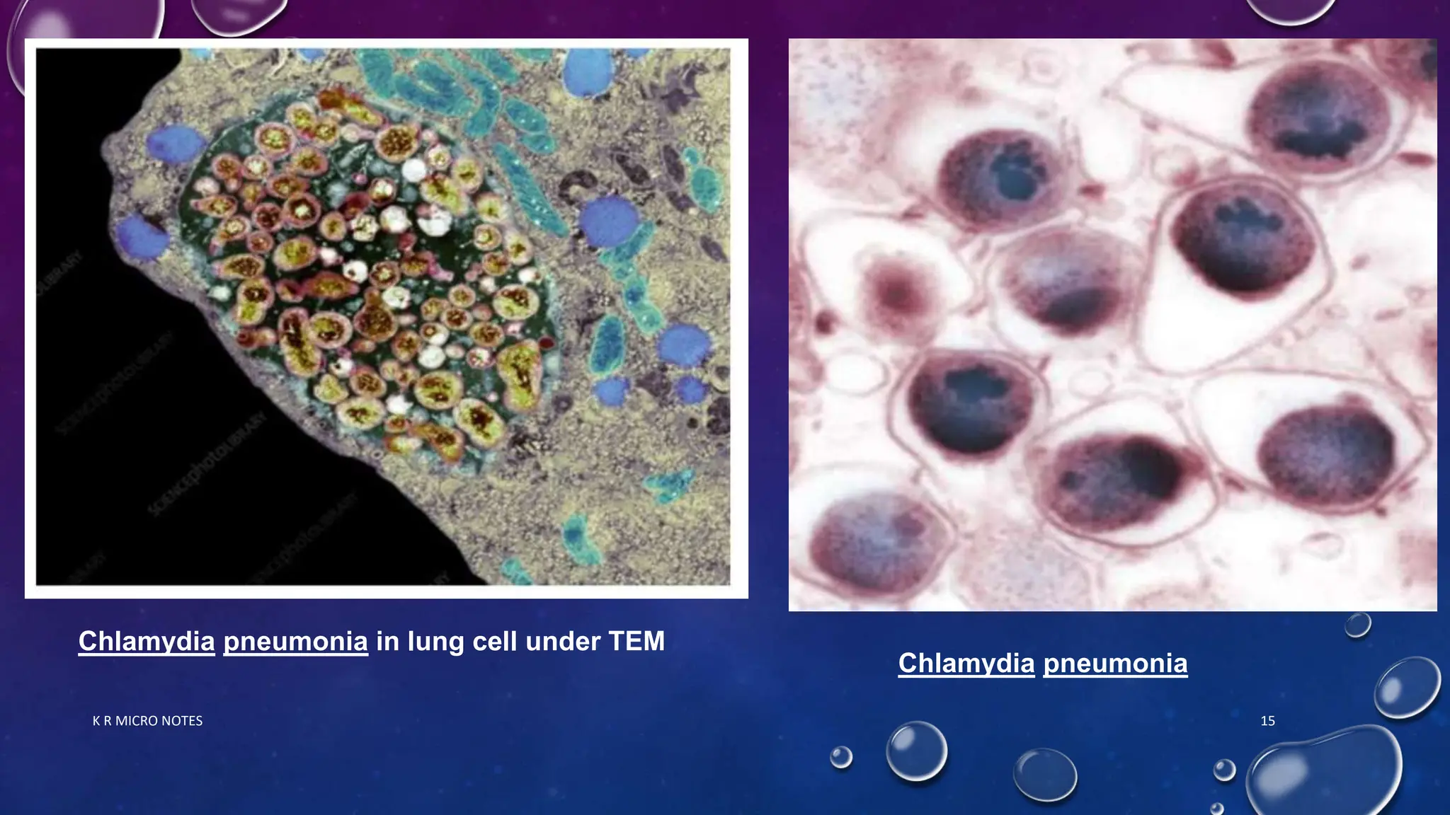 Chlamydiae The silent killer K R.pptx