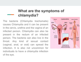 Chlamydia infections | PPTX