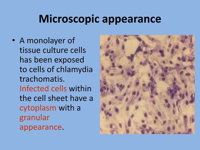 Chlamydial infections & ophthalmia neonatorum | PPTX | Eye and Vision ...