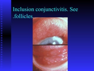 Atypical Bacteria chlamydia+ mycoplasma.ppt