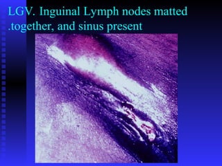 Atypical Bacteria chlamydia+ mycoplasma.ppt