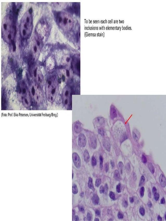 Chlamydia Bacteria Shape