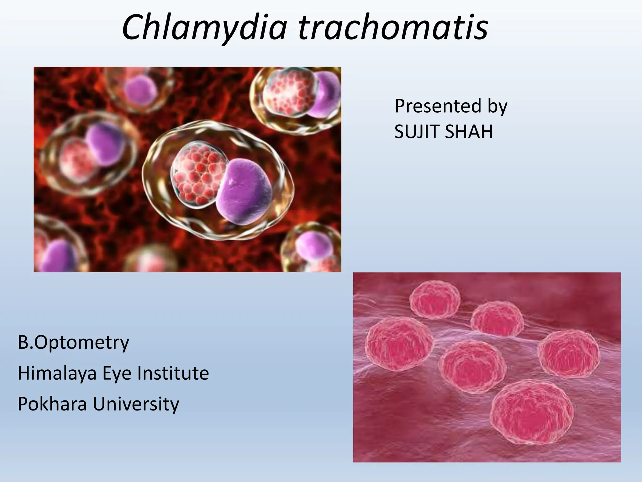 Chlamydia trachomatis.pptx microbiology | PPTX
