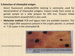 Chlamydia trachomatis.pptx microbiology | PPTX