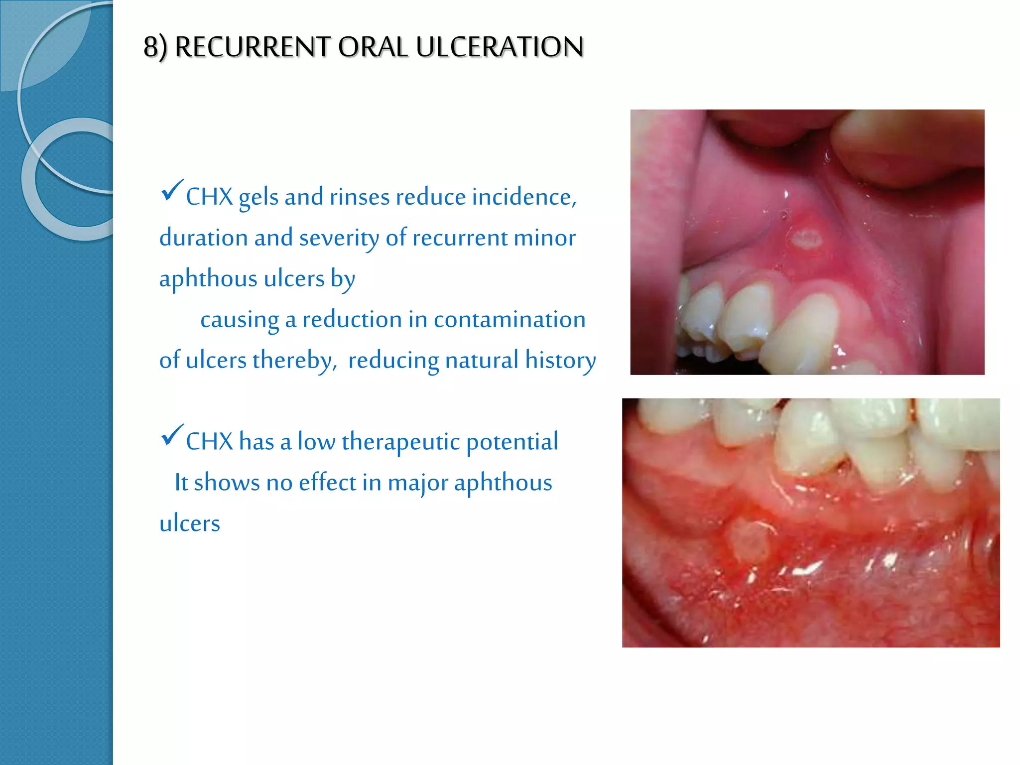 Chlorhexidine | PPTX | Skin Care | Beauty