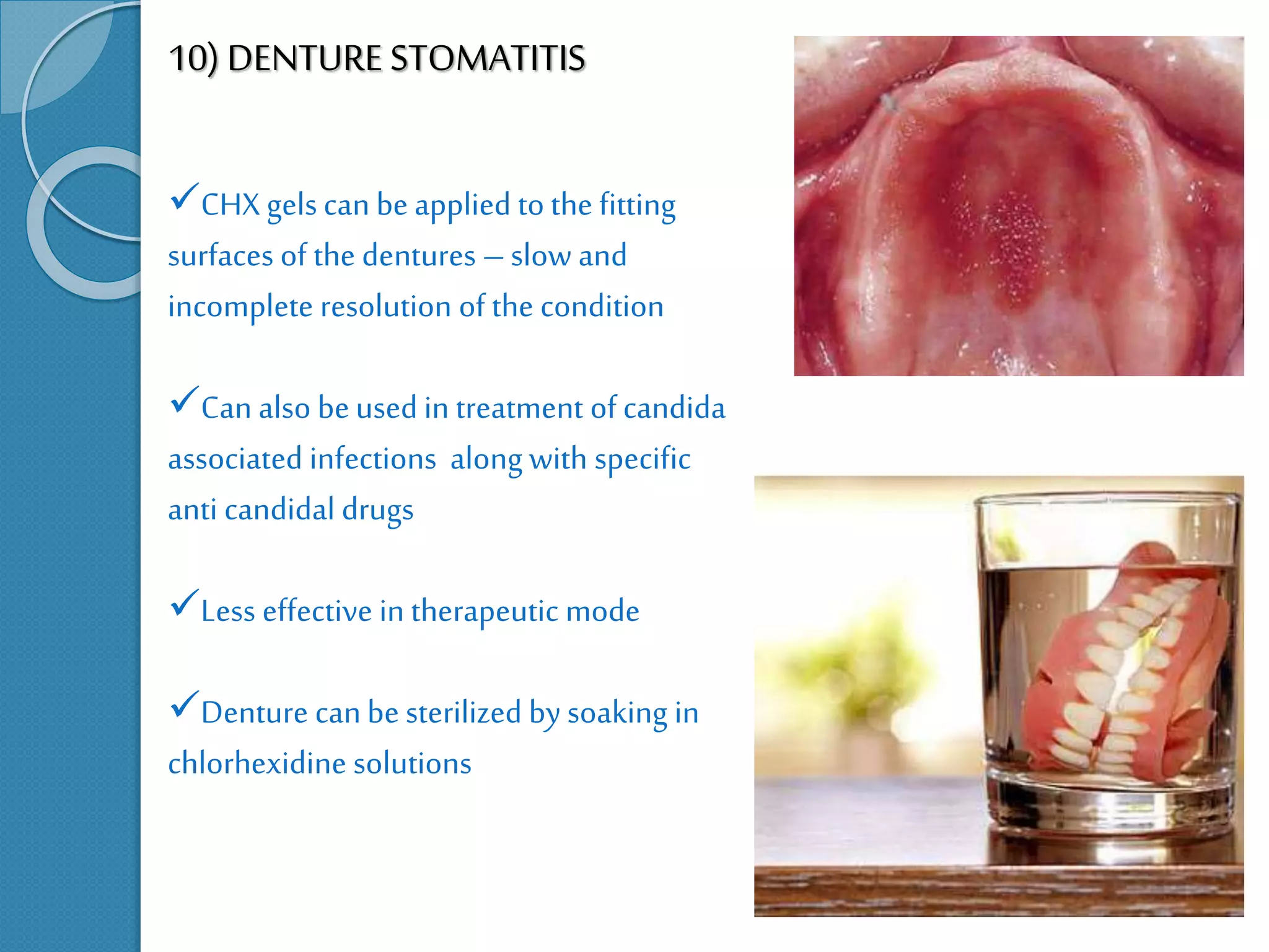 Chlorhexidine | PPTX | Skin Care | Beauty