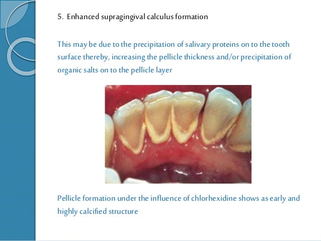 Utooth TOOTHTOOTH GARDEN RESTAURANT̗͈x.com Xg