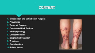 purpura and nursing management .pptx