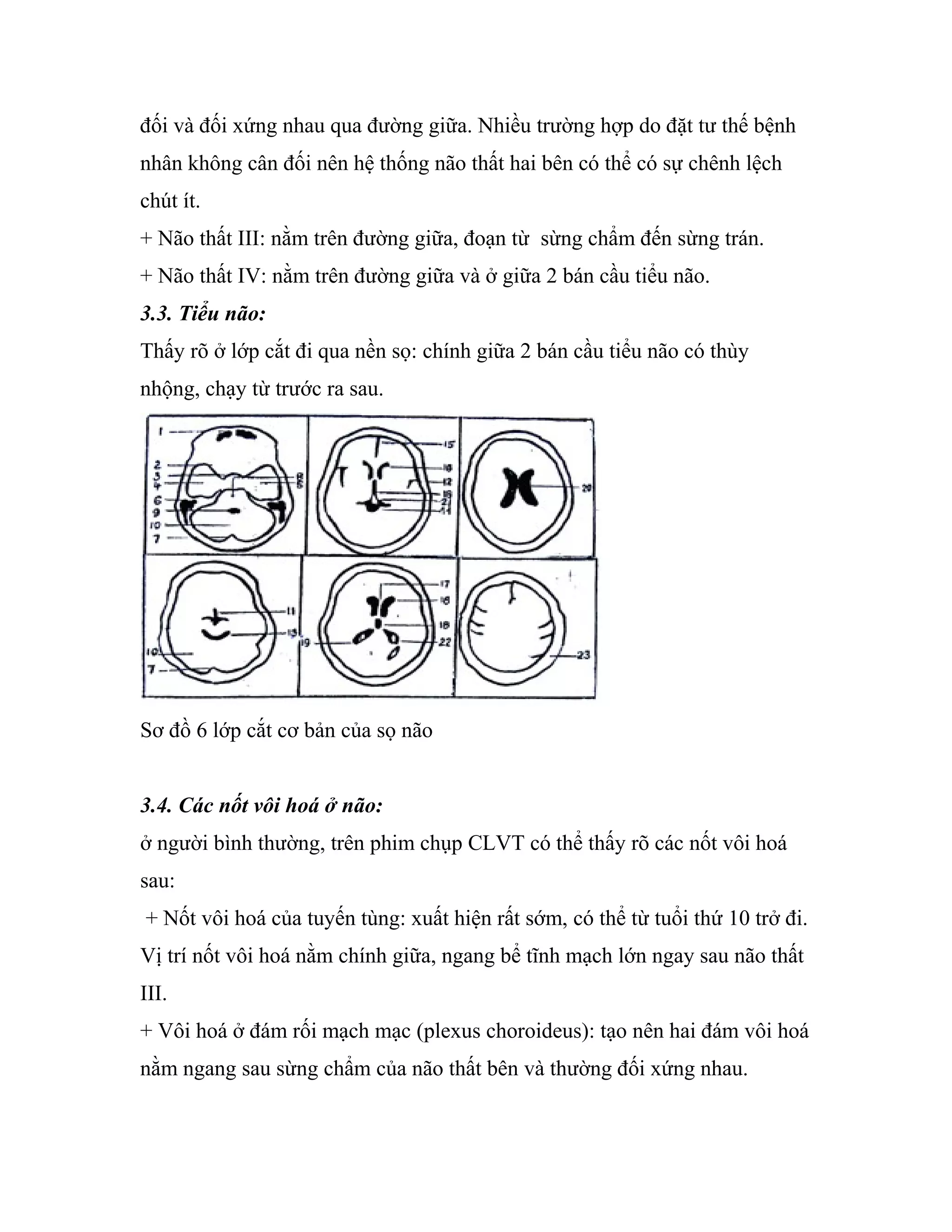 Chẩn đoán bệnh lý sọ não trên phim cắt lớp vi tính | DOC