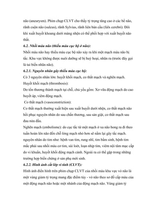 Chẩn đoán bệnh lý sọ não trên phim cắt lớp vi tính | DOC