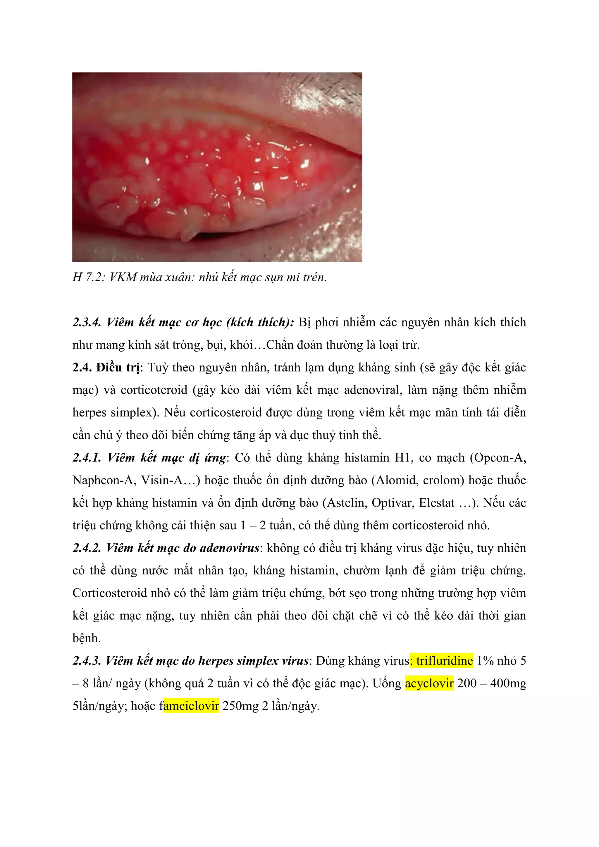 CHẨN ĐOÁN VÀ XỬ LÝ ĐỎ MẮT | PDF