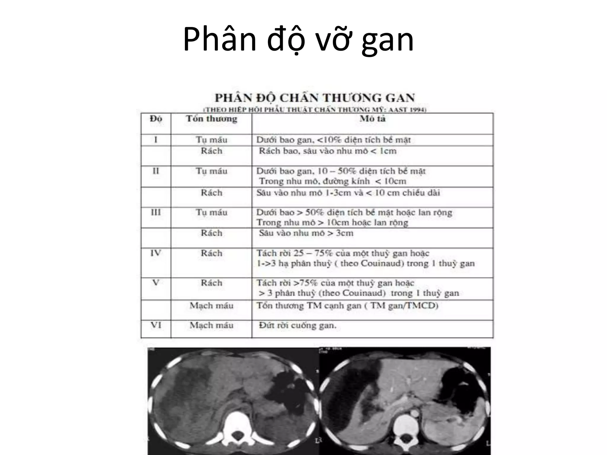 CHẤN THƯƠNG BỤNG KÍN - Thầy Phước.pptx