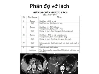 CHẤN THƯƠNG BỤNG KÍN - Thầy Phước.pptx