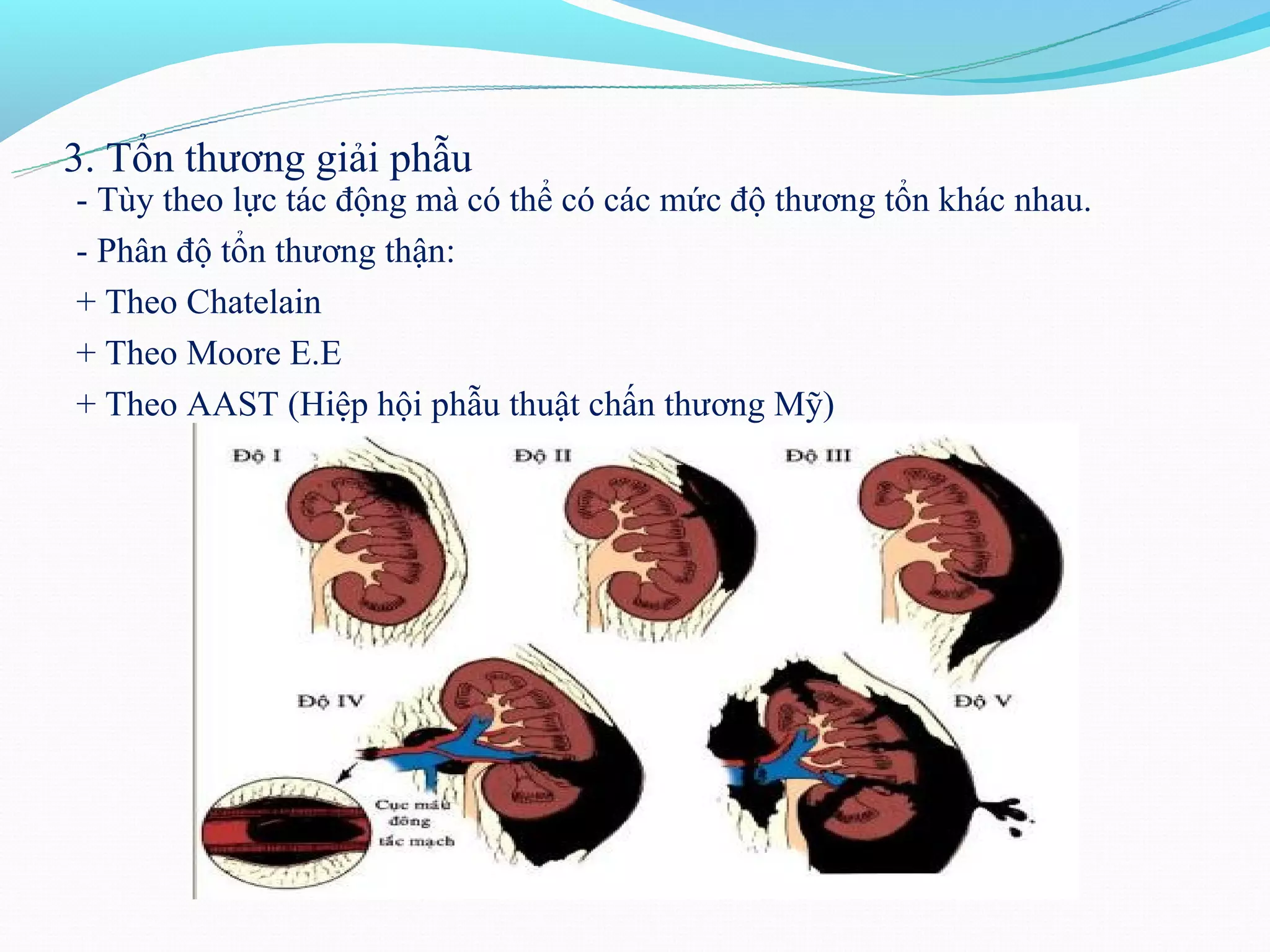 Chấn thương thận | PPT
