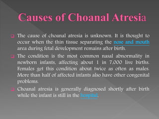 Choanal atresia: Symptoms, causes, treatment and Prevention. | PPTX