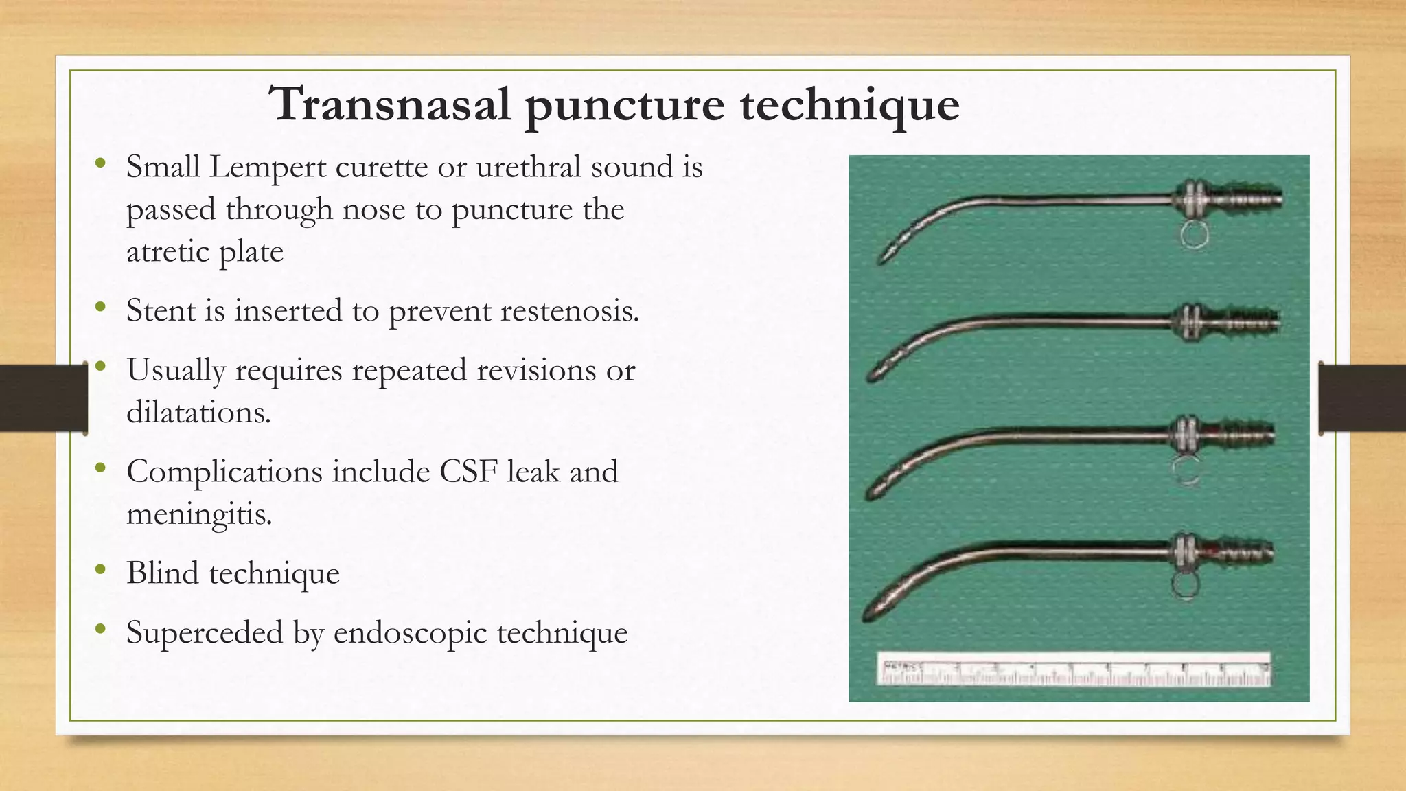 Choanal atresia | PPTX
