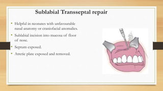 Choanal atresia | PPTX