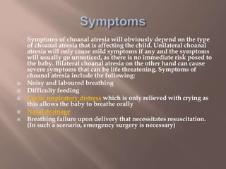 Choanal atresia | PPTX