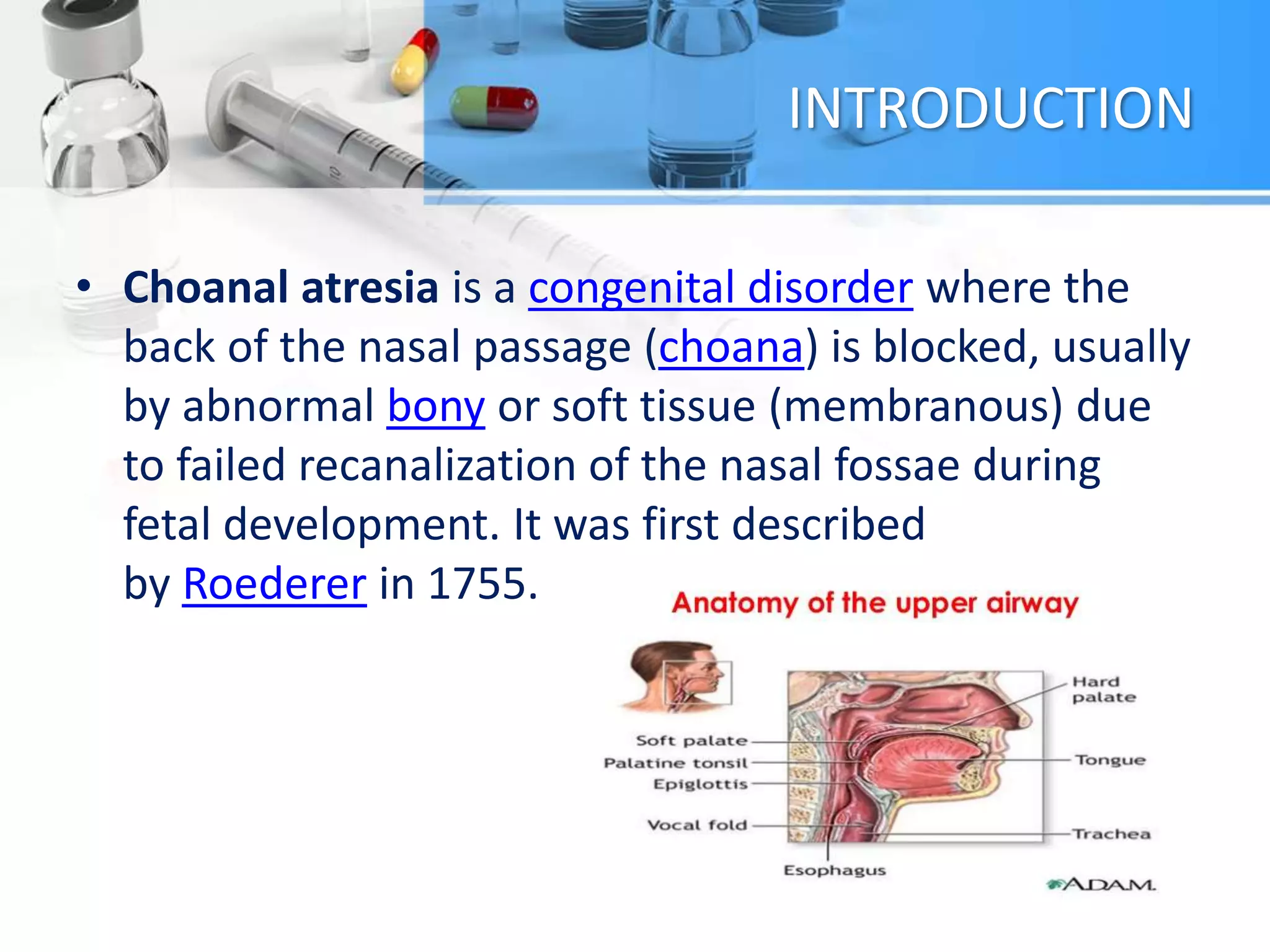 Choanal atresia | PPTX