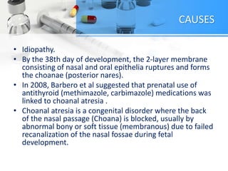 Choanal atresia | PPTX