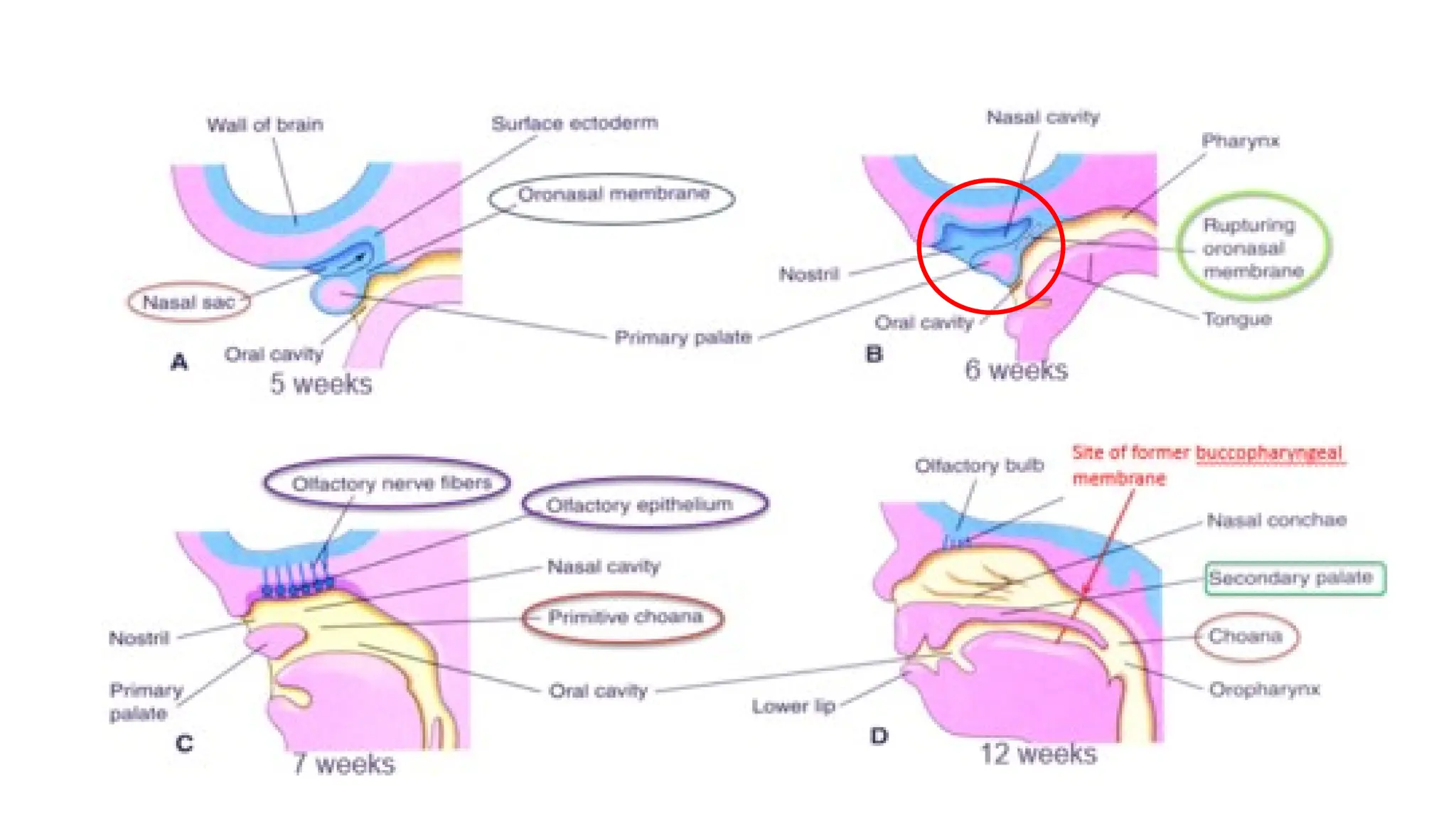 CHOANAL ATRESIA IN RELATION TO METHIMAZOLE USE | PPTX