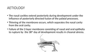 CHOANAL ATRESIA BY DR KWANKIYEL_034627.pptx