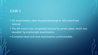 choanal atresia case presentation causes | PPTX