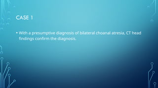 choanal atresia case presentation causes | PPTX