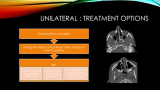 Choanal Atresia journal club surgical operations | PPTX