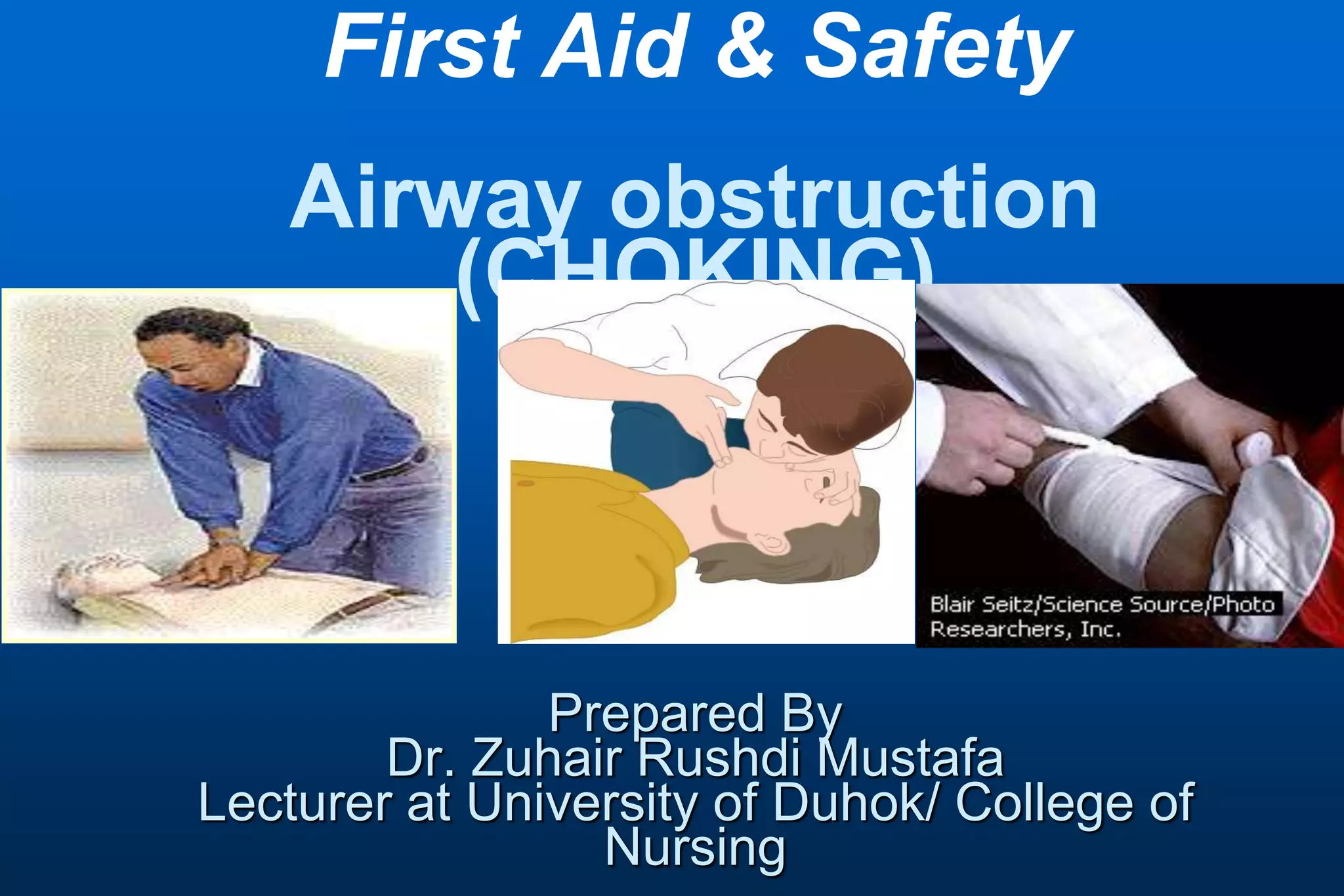 Choking | PPT