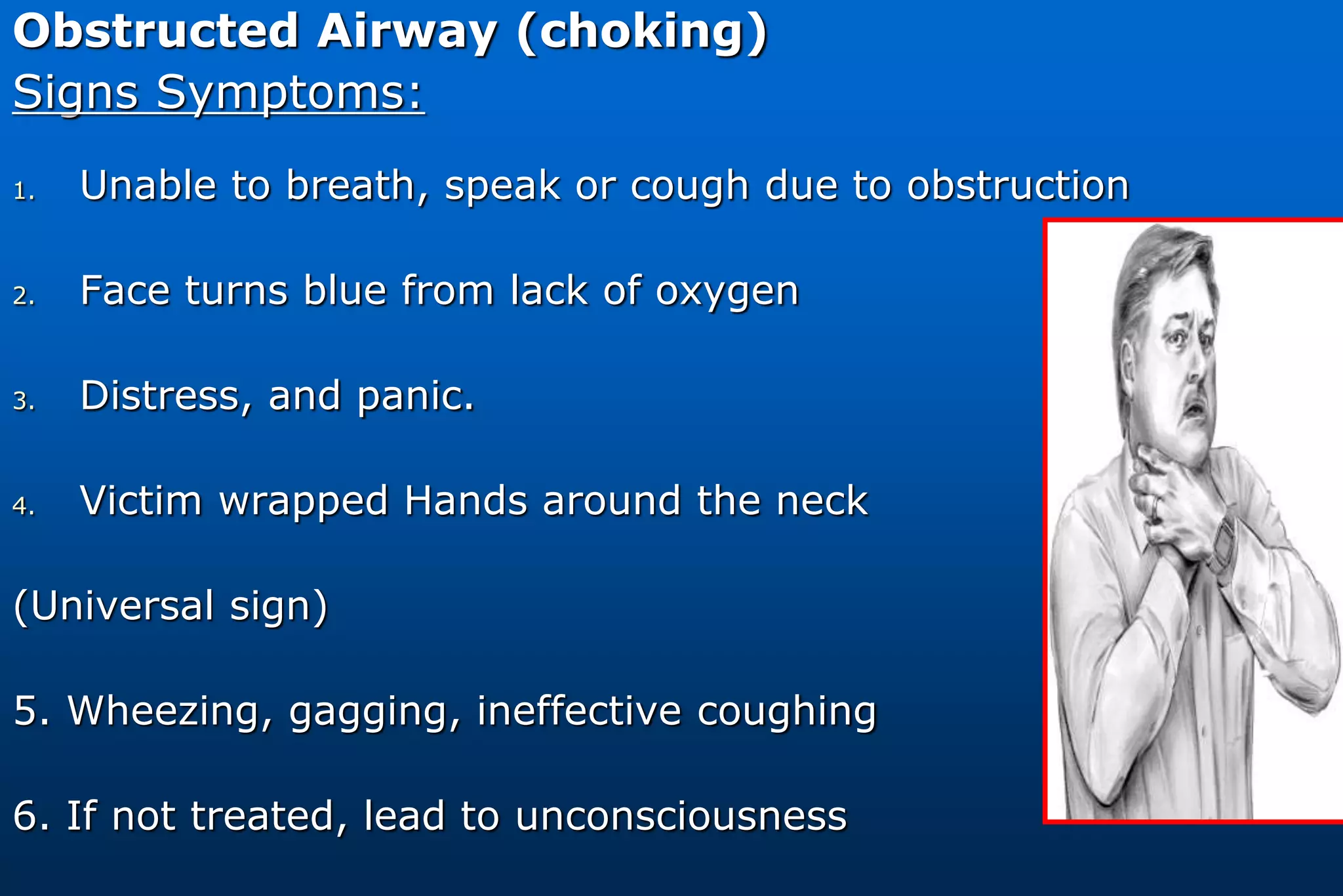 Choking | PPT