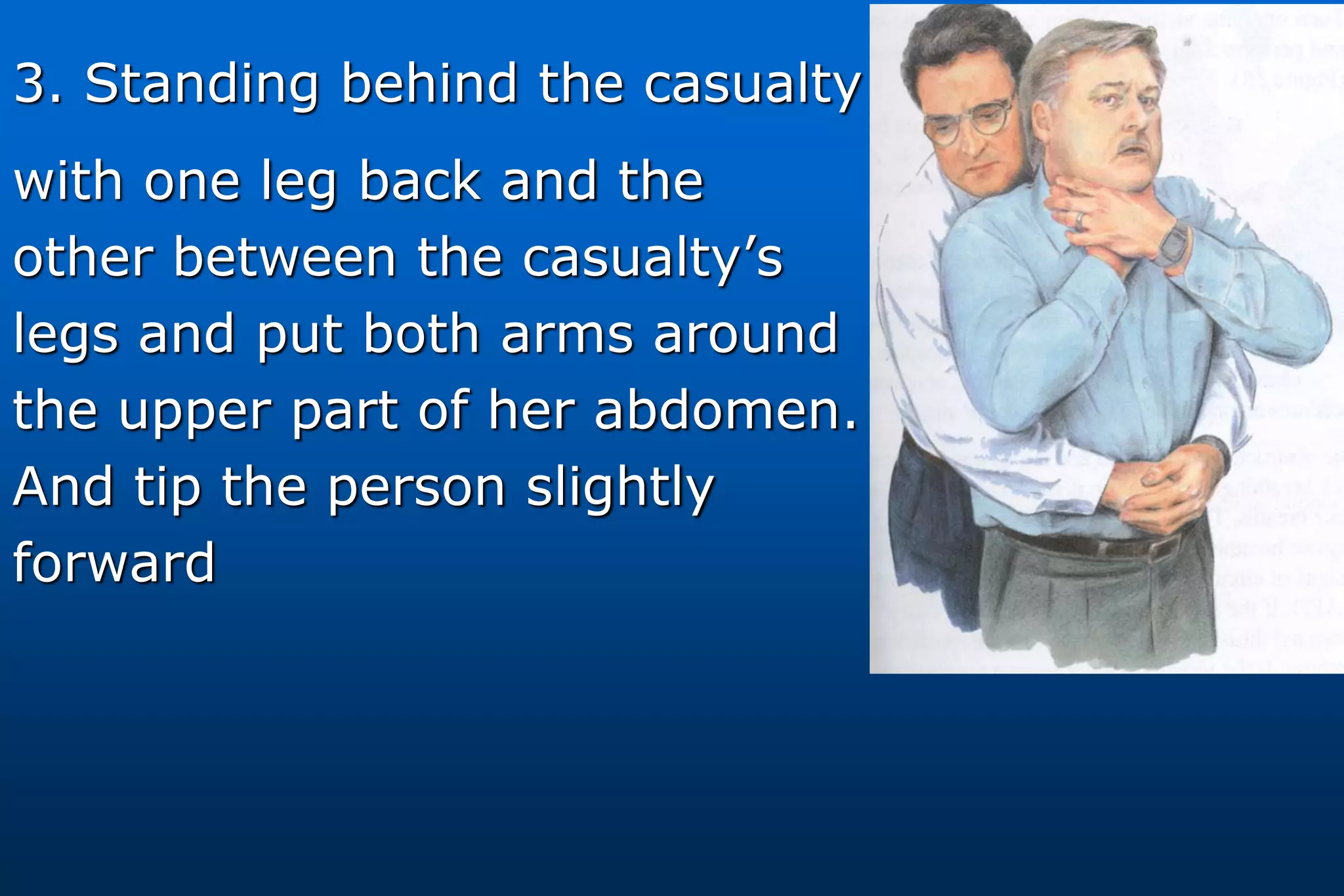 Choking | PPT