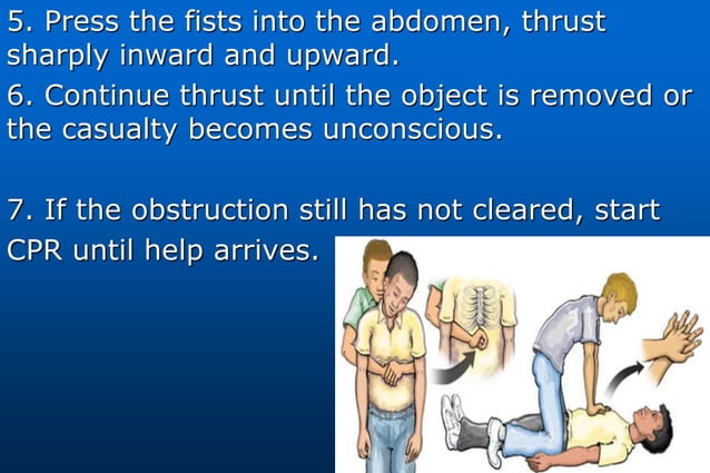 Choking | PPT | First Aid | Injuries