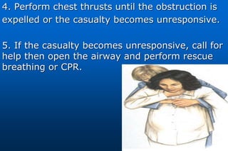 Choking | PPT