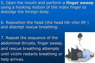 Choking | PPT