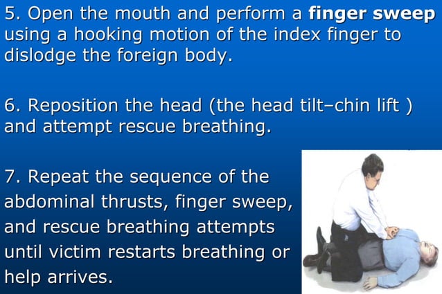 Choking | PPT | First Aid | Injuries
