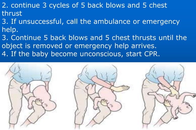Choking | PPT | First Aid | Injuries