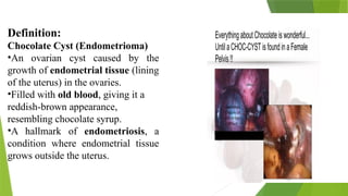 A brief presentation on Chocolate cyst.pptx