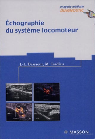 éChographie du système locomoteur | PDF