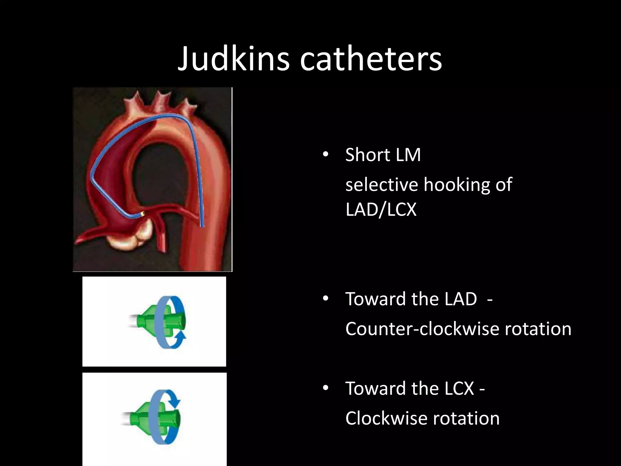 Choice of guiding catheters in PCI | PPTX