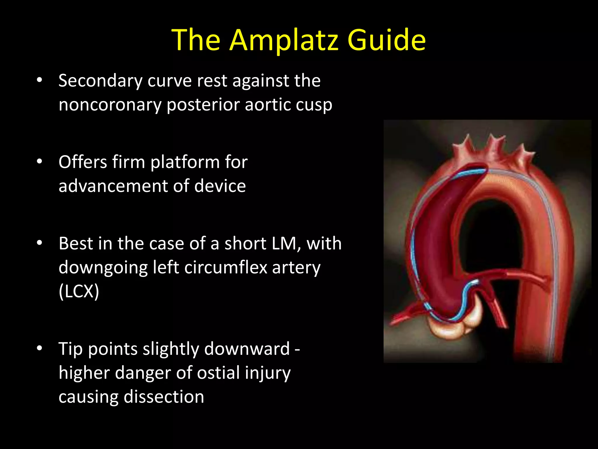 Choice of guiding catheters in PCI | PPTX