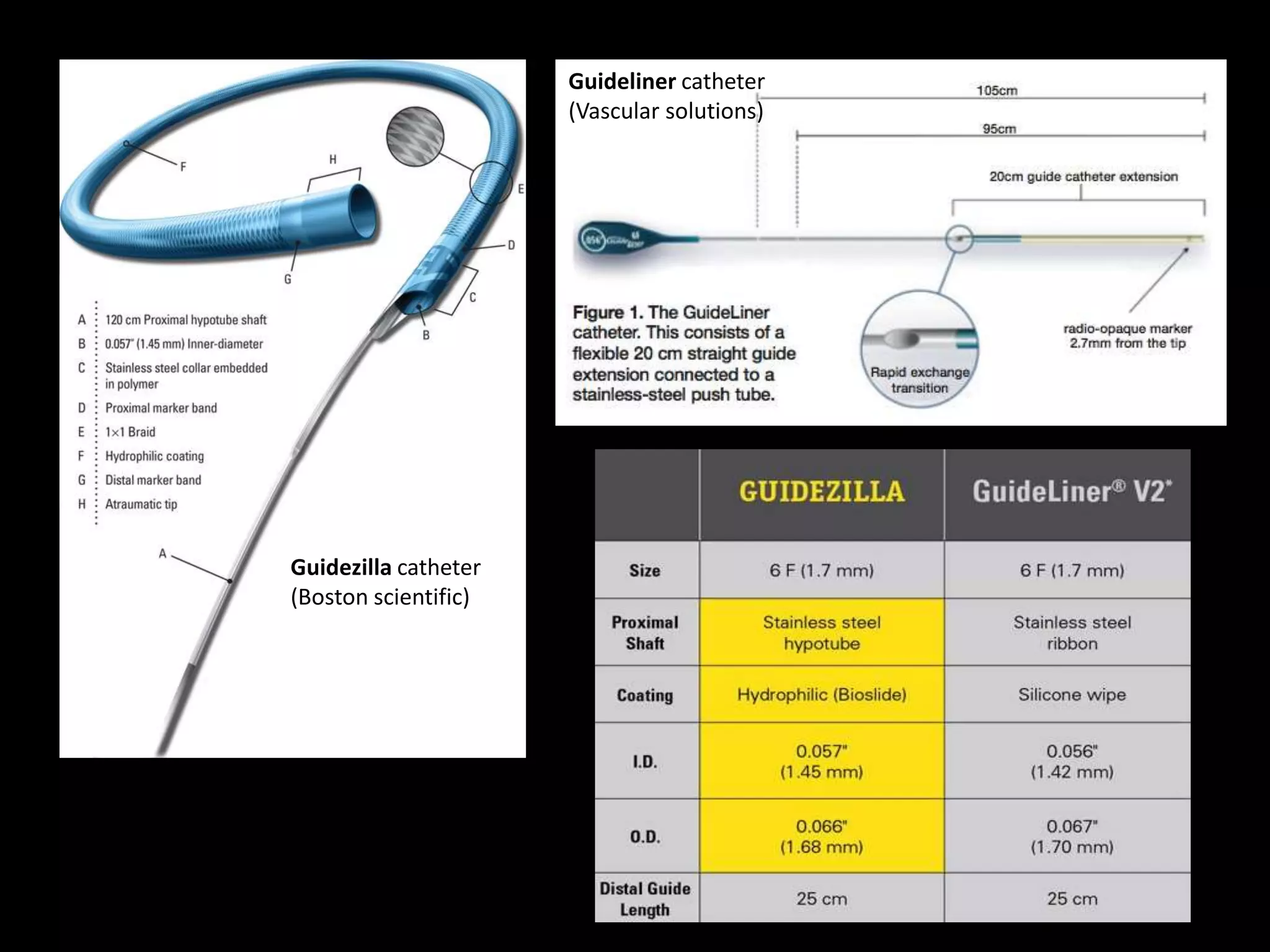 Choice of guiding catheters in PCI | PPTX