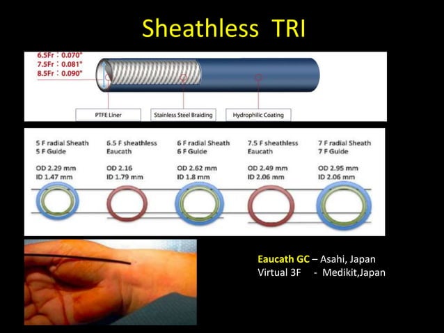 Choice of guiding catheters in PCI | PPTX